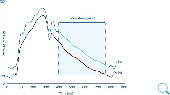 Coronary Physiology Modalities: iFR and FFR | Philips