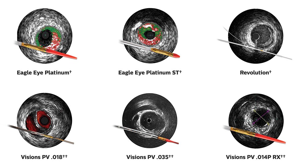 Intravascular Ultrasound (IVUS) | Philips Healthcare