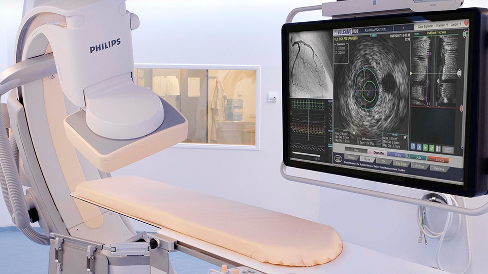 Intravascular Ultrasound (IVUS) | Philips Healthcare