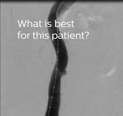 IVUS - Intravascular Ultrasound | Philips Healthcare