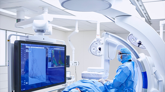 Peripheral arterial interventions | Philips